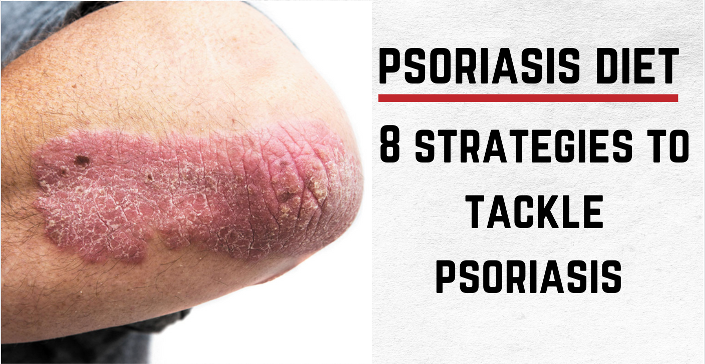 Psoriasis Diet: 8 Ways to Take on Psoriasis from the Inside – Carnivore ...